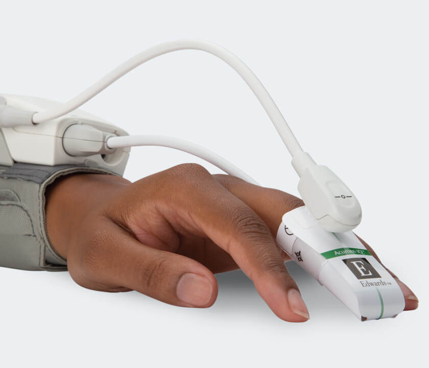 Acumen IQ cuff | Edwards Lifesciences