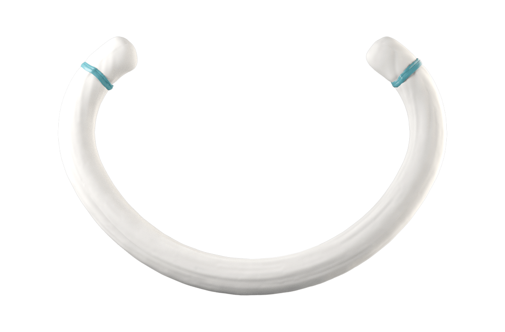 Mitral Valve Repair | Edwards Lifesciences