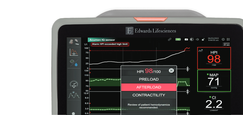 Acumen Hypotension Prediction Index software | Edwards Lifesciences