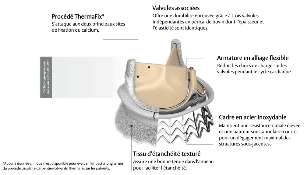 Système de valve Edwards Intuity Elite | Edwards Lifesciences
