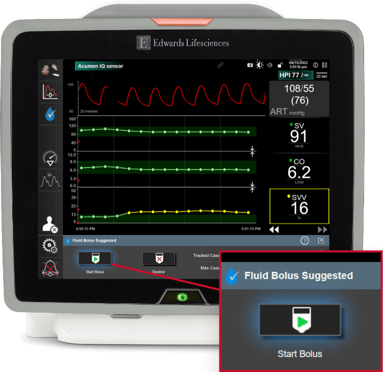 Acumen Assisted Fluid Management software | Edwards Lifesciences