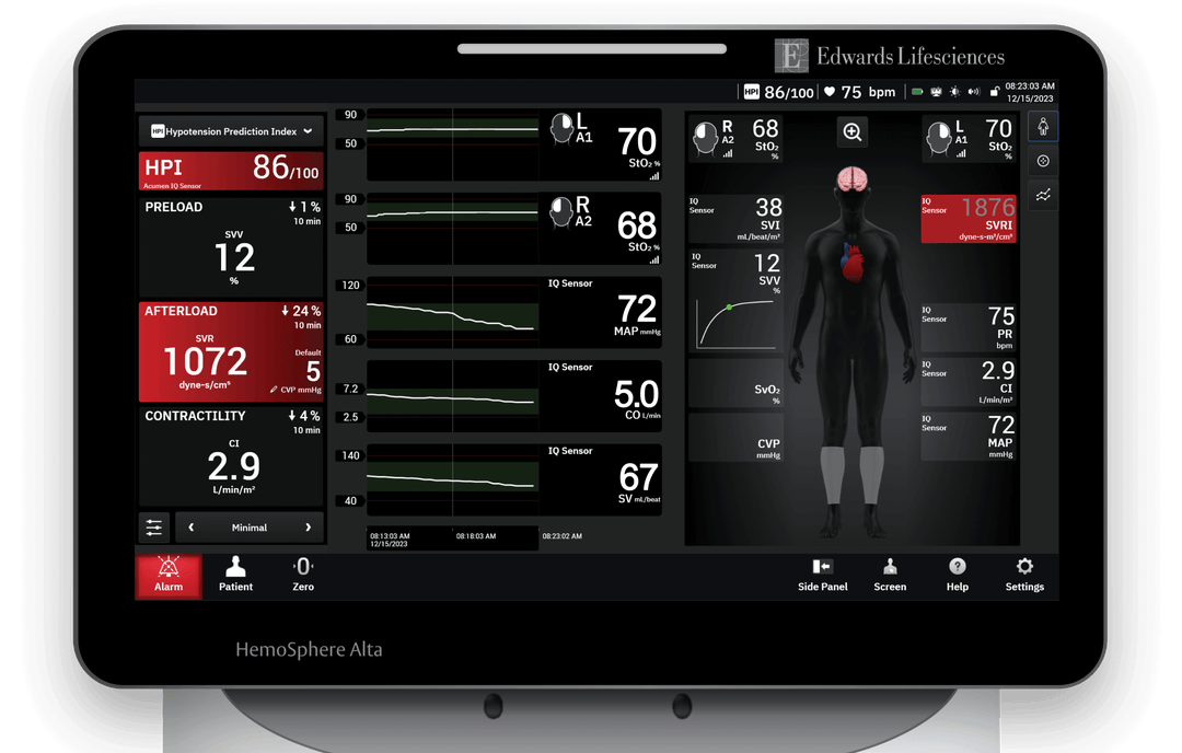 HemoSphere Alta monitor | Edwards Lifesciences