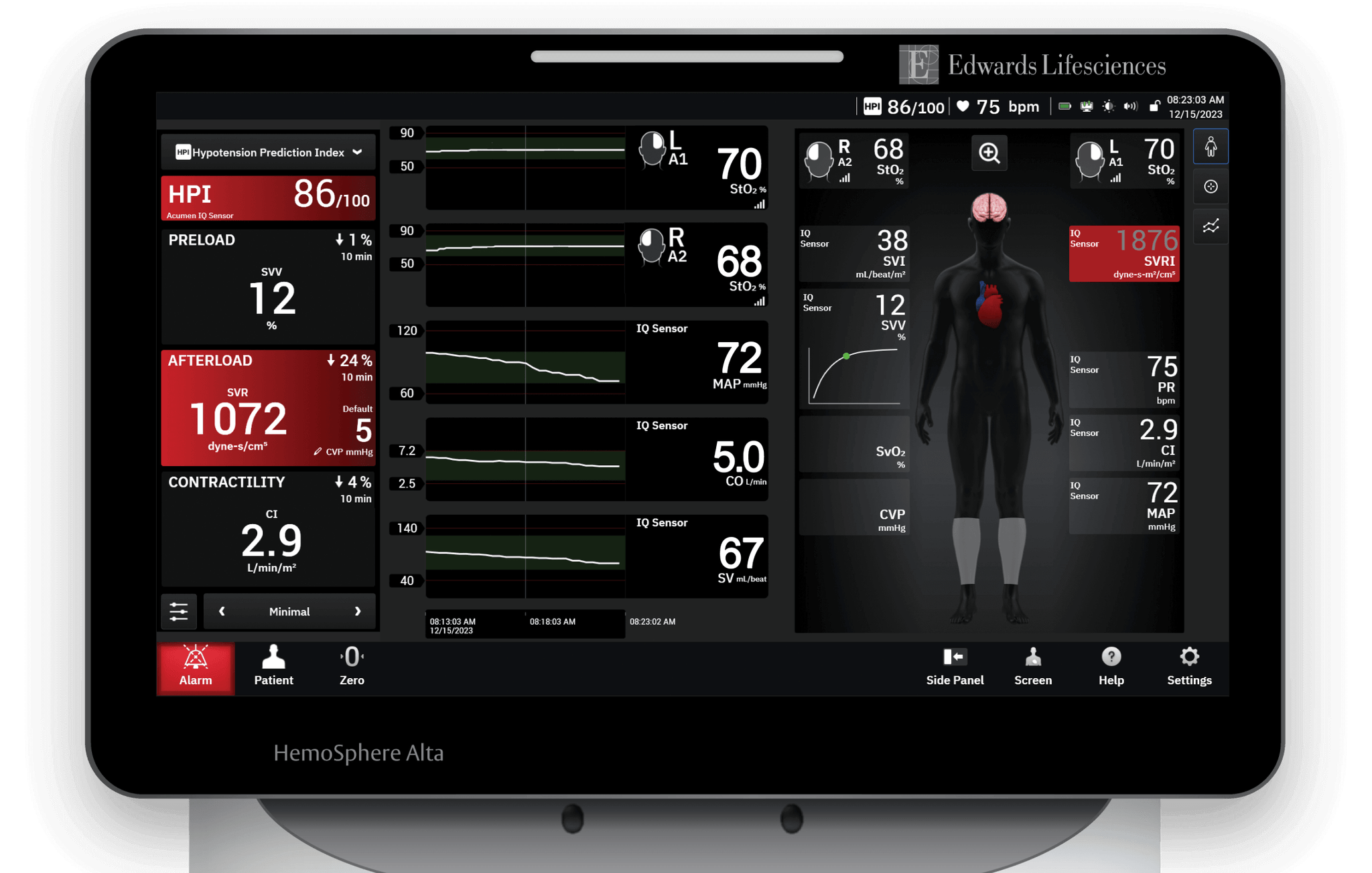 HemoSphere Alta monitor | Edwards Lifesciences