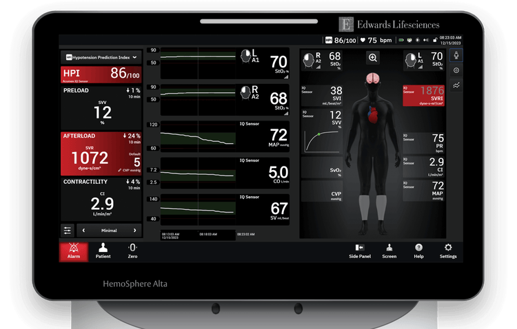 HemoSphere Alta monitor | Edwards Lifesciences