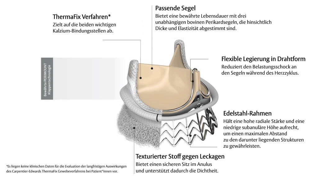 Edwards INTUITY Elite Klappensystem | Edwards Lifesciences