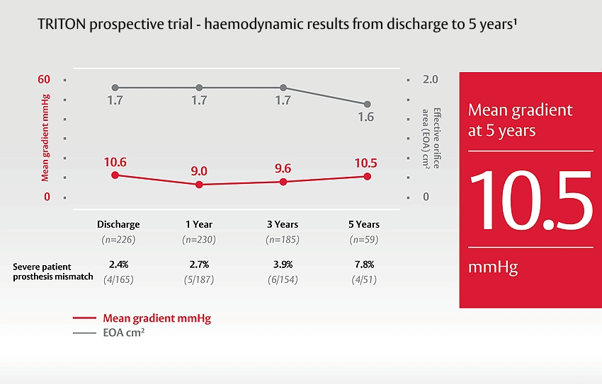 Edwards Intuity Elite valve system | Edwards Lifesciences