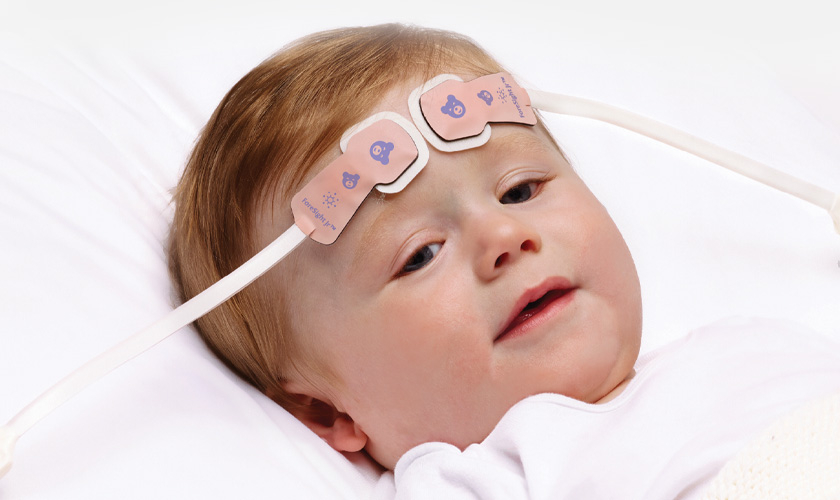 ForeSight tissue oximetry sensor | Edwards Lifesciences