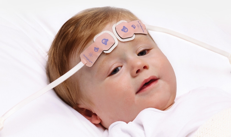 ForeSight tissue oximetry sensor | Edwards Lifesciences