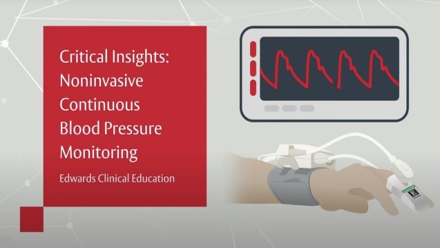 HemoSphere Vita monitor | Edwards Lifesciences