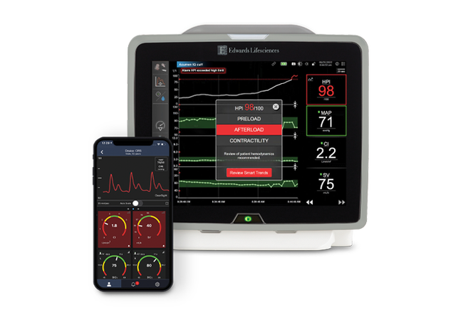 Viewfinder Remote App | Edwards Lifesciences