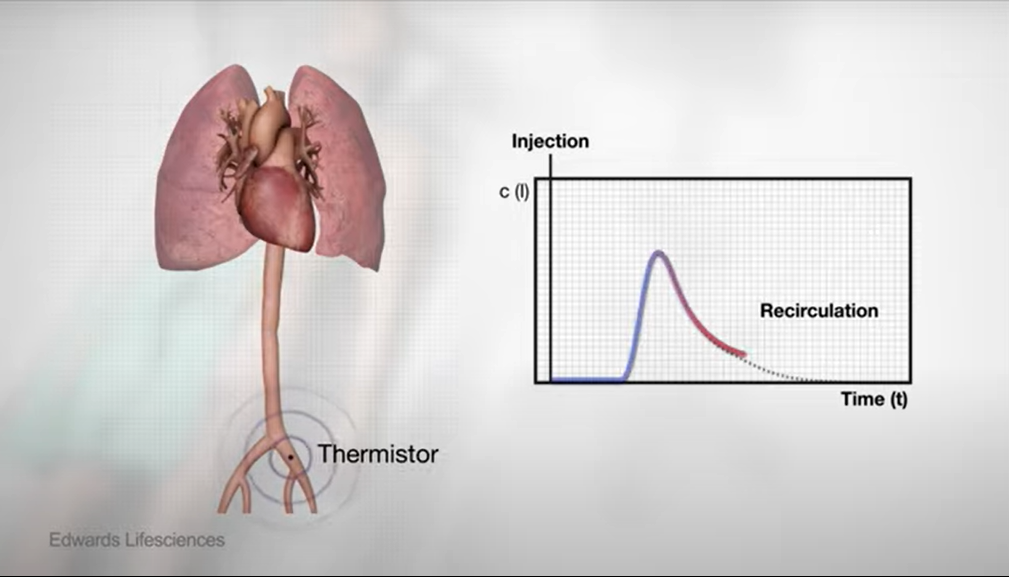 VolumeView System | Edwards Lifesciences