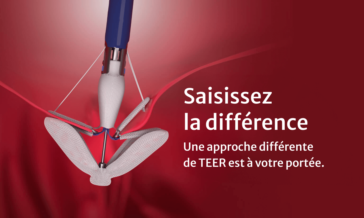 The PASCAL Precision system | Edwards Lifesciences