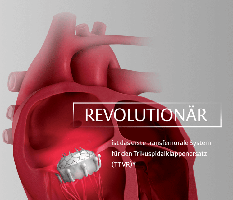 EVOQUE Trikuspidalklappenersatz | Edwards Lifesciences