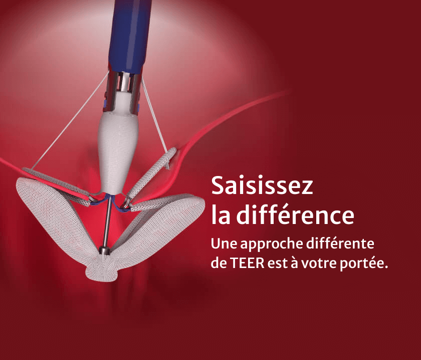 The PASCAL Precision system | Edwards Lifesciences