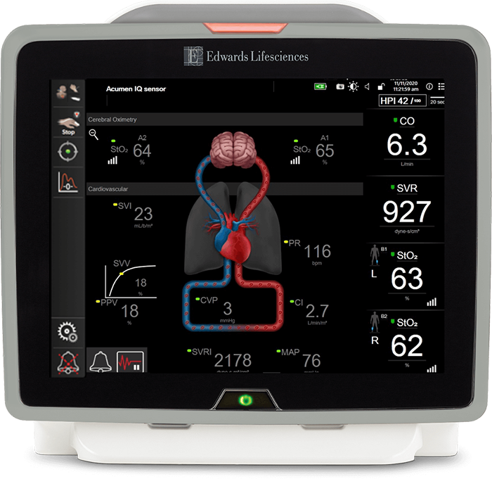 ForeSight tissue oximetry sensor | Edwards Lifesciences