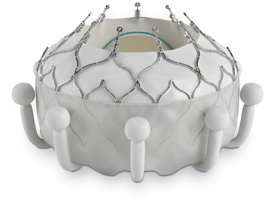 Severe tricuspid valve regurgitation and treatment | Edwards Lifesciences