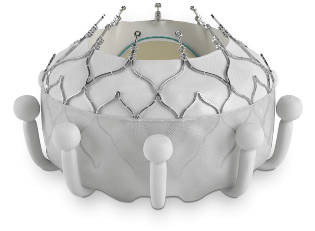 Severe tricuspid valve regurgitation and treatment | Edwards Lifesciences