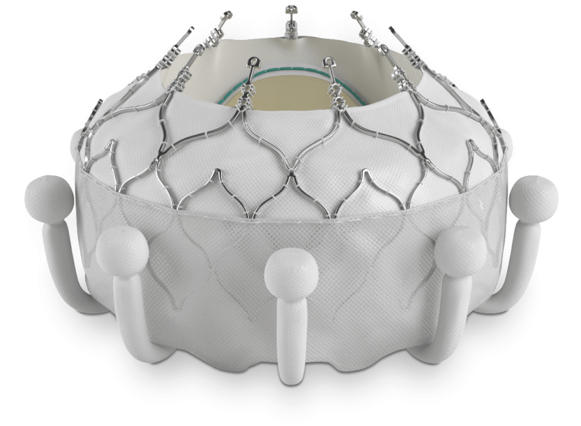 Severe tricuspid valve regurgitation and treatment | Edwards Lifesciences