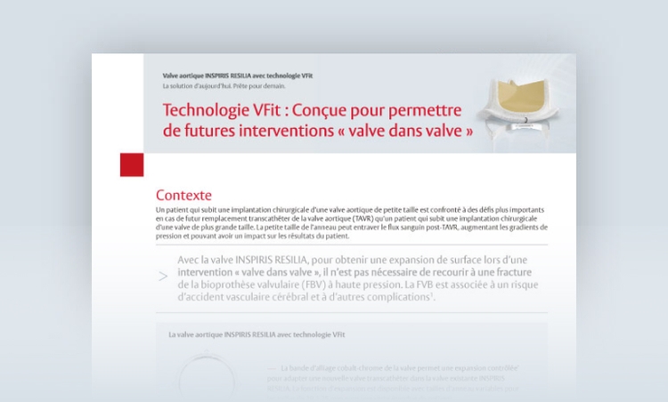 Valve aortique INSPIRIS RESILIA | Edwards Lifesciences