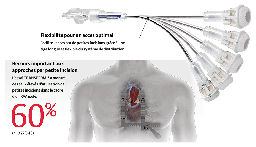 Système de valve Edwards Intuity Elite | Edwards Lifesciences
