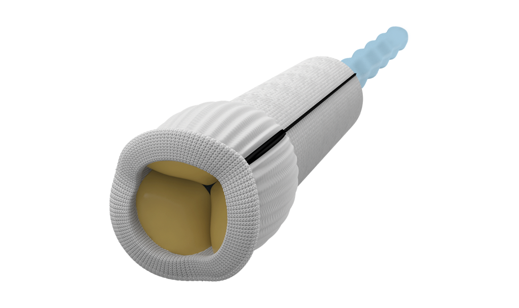 RESILIA tissue | Edwards Lifesciences