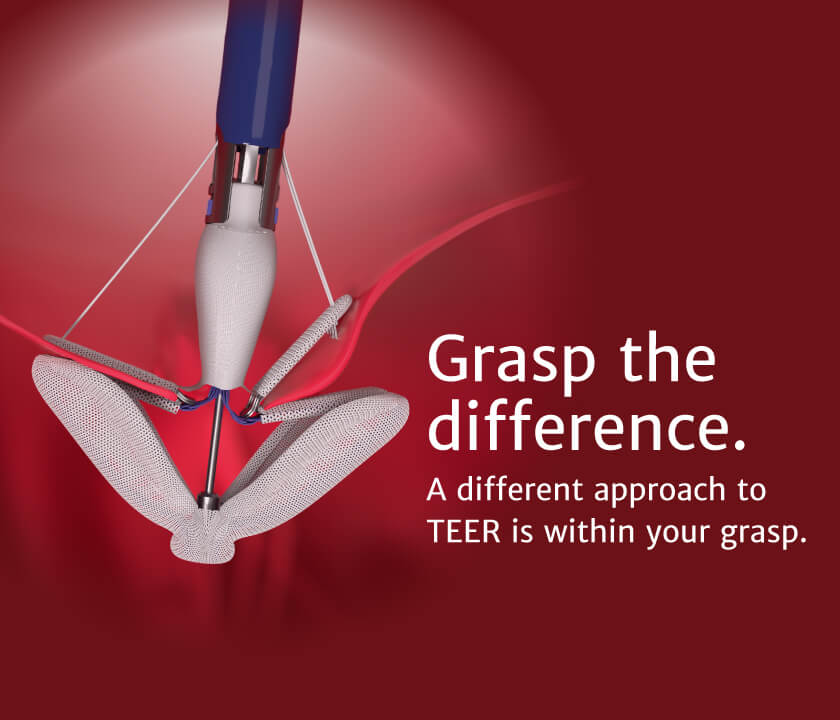 The PASCAL Precision system | Edwards Lifesciences