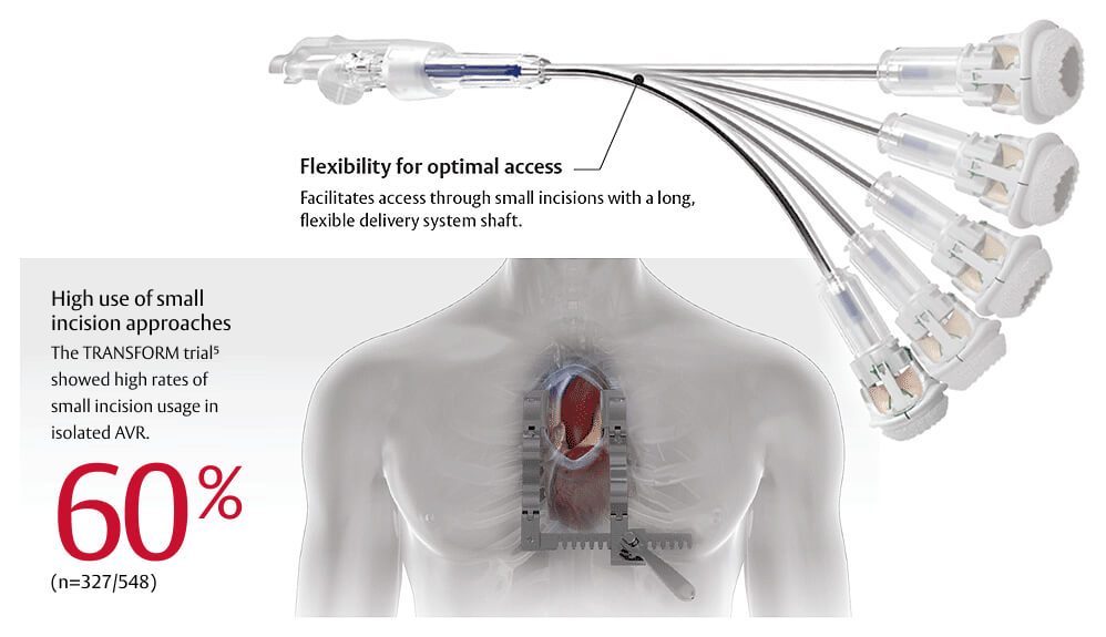 Edwards Intuity Elite valve system | Edwards Lifesciences