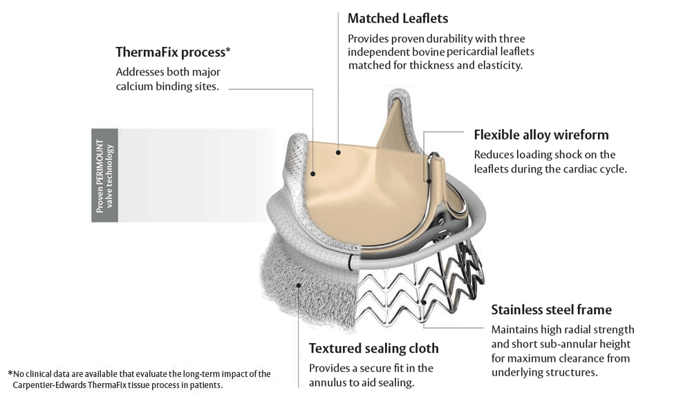 Edwards Intuity Elite valve system | Edwards Lifesciences