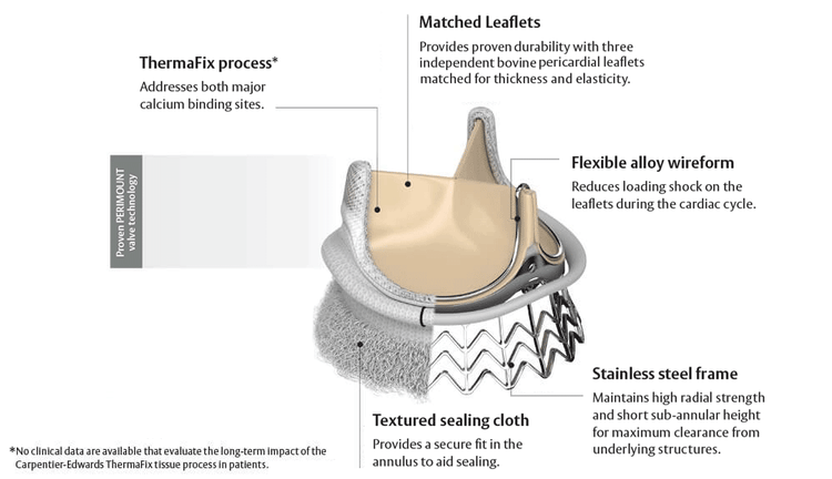 Edwards Intuity Elite valve system | Edwards Lifesciences