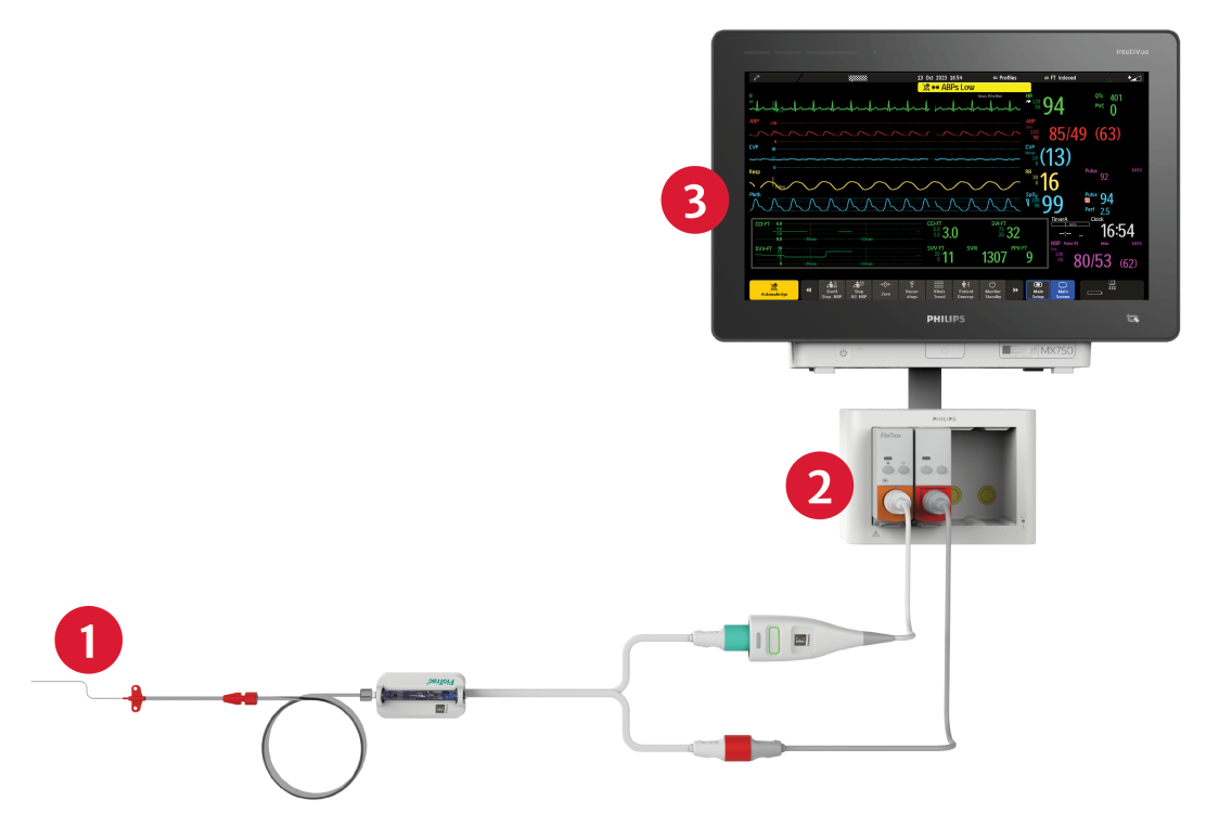 Philips Flotrac | Edwards Lifesciences