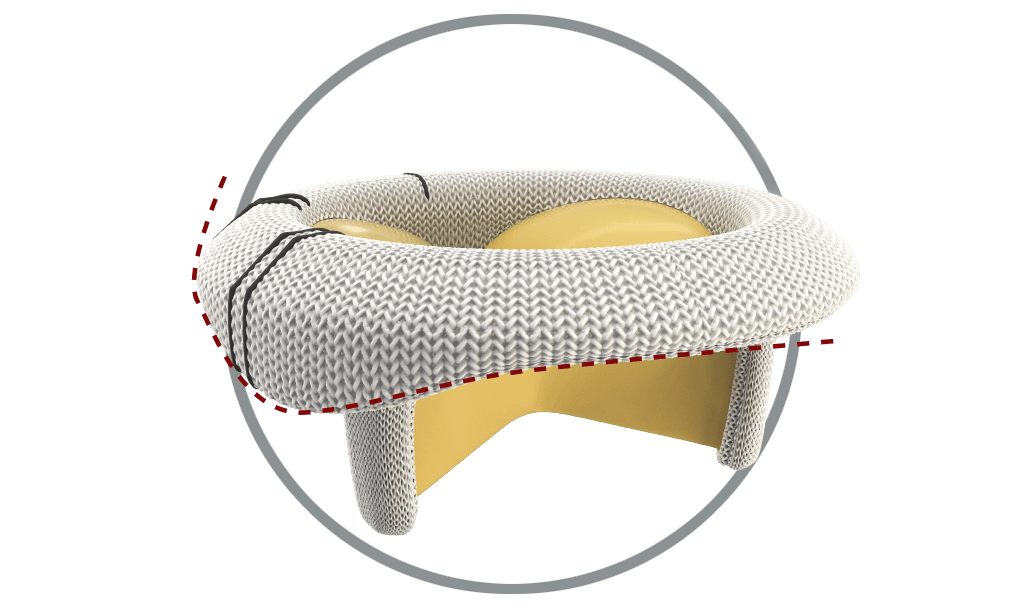 MITRIS RESILIA mitral valve | Edwards Lifesciences