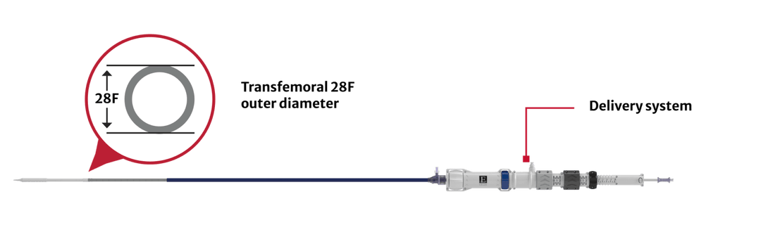 EVOQUE Tricuspid Valve Replacement | Edwards Lifesciences
