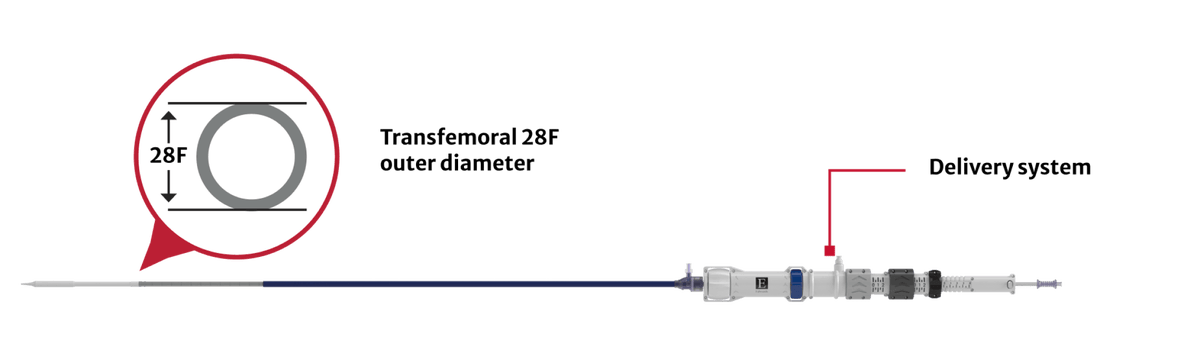 EVOQUE Tricuspid Valve Replacement | Edwards Lifesciences