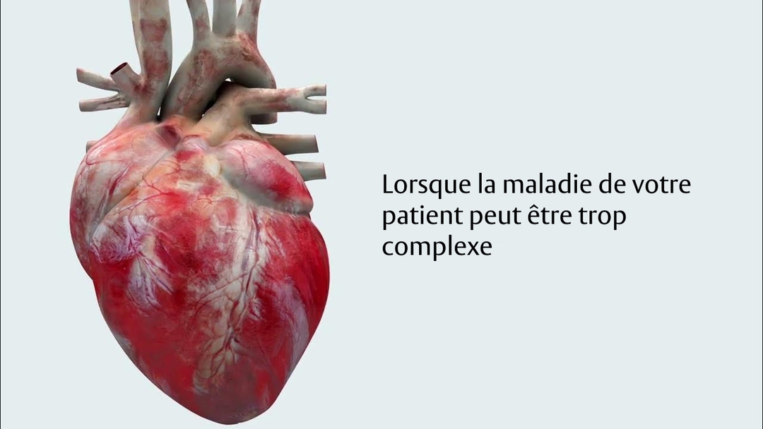 Valve mitrale MITRIS RESILIA | Edwards Lifesciences