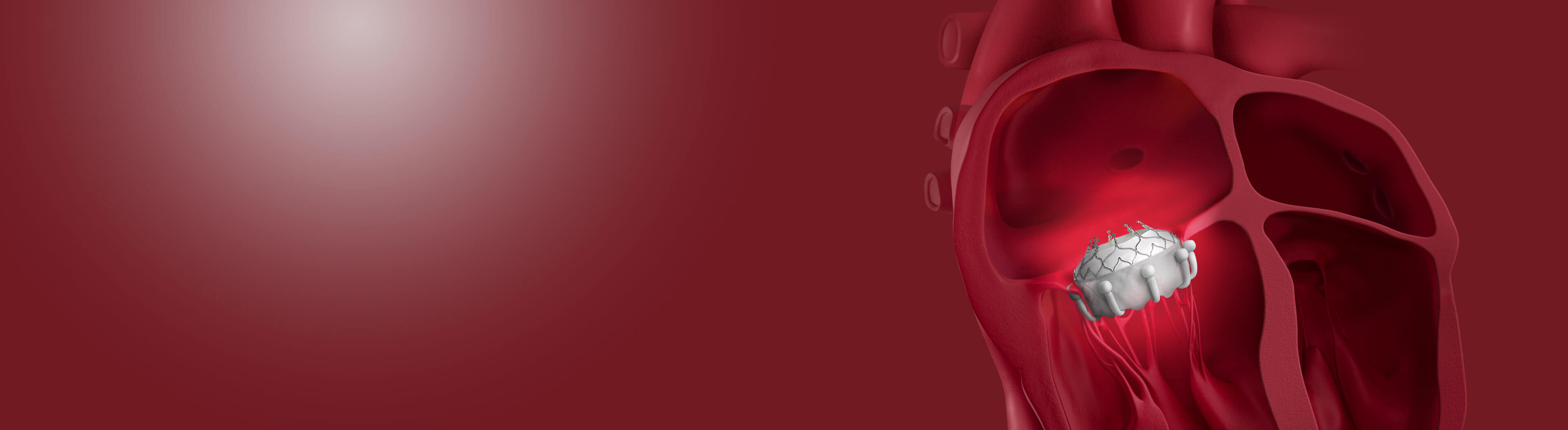 The Edge | Edwards Lifesciences