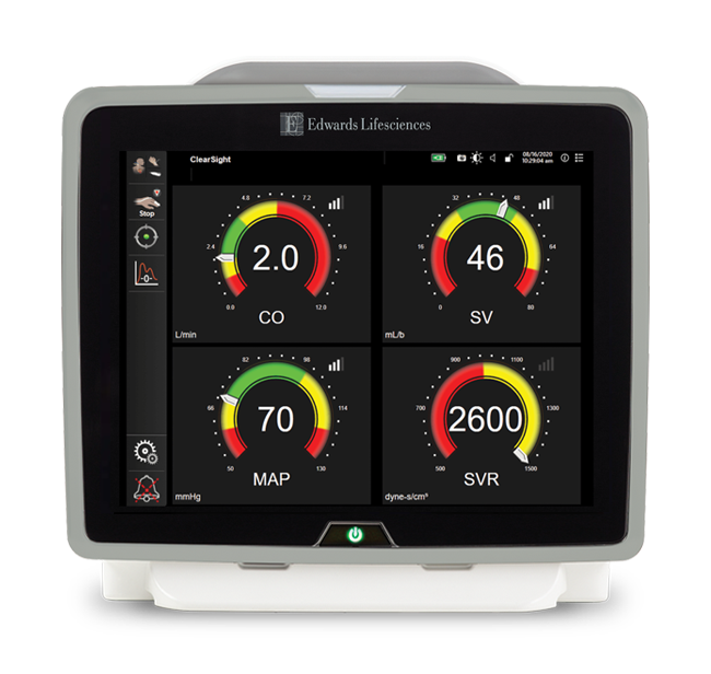 Acumen Hypotension Prediction Index software | Edwards Lifesciences
