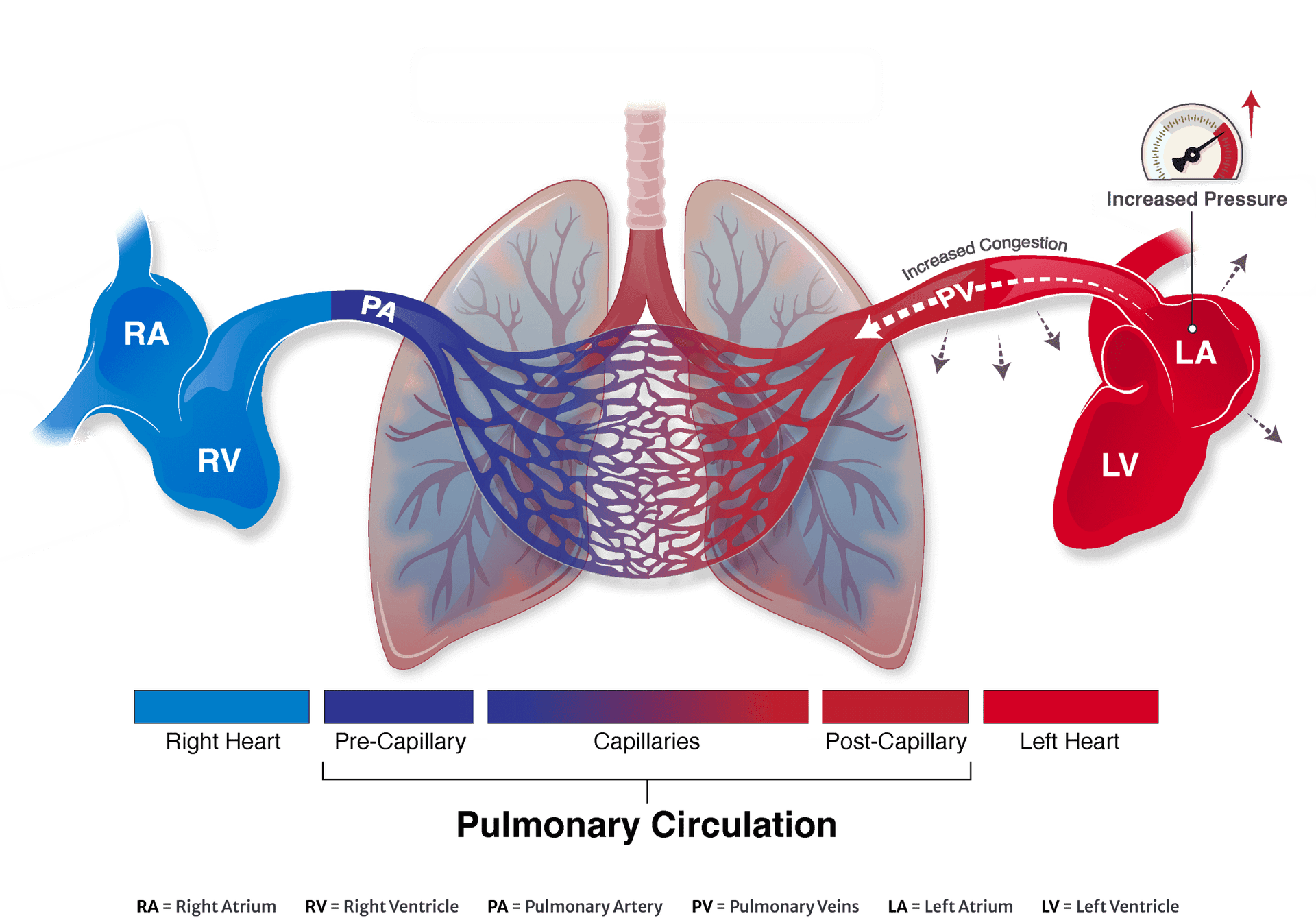 ALT-FLOW trial | Edwards Lifesciences