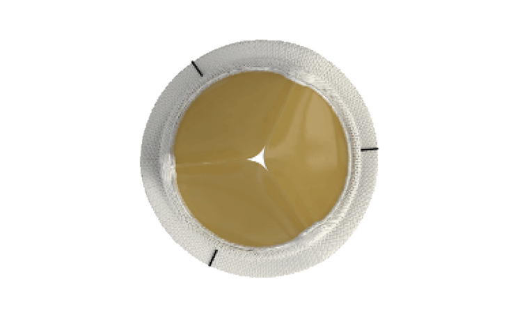 Surgical valve replacement | Edwards Lifesciences