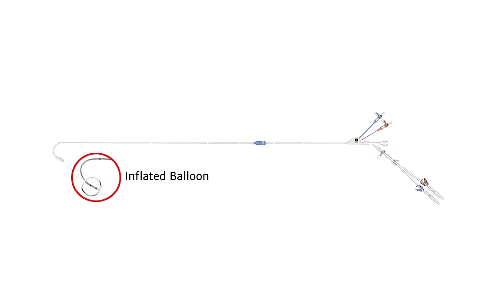 IntraClude Device | Edwards Lifesciences