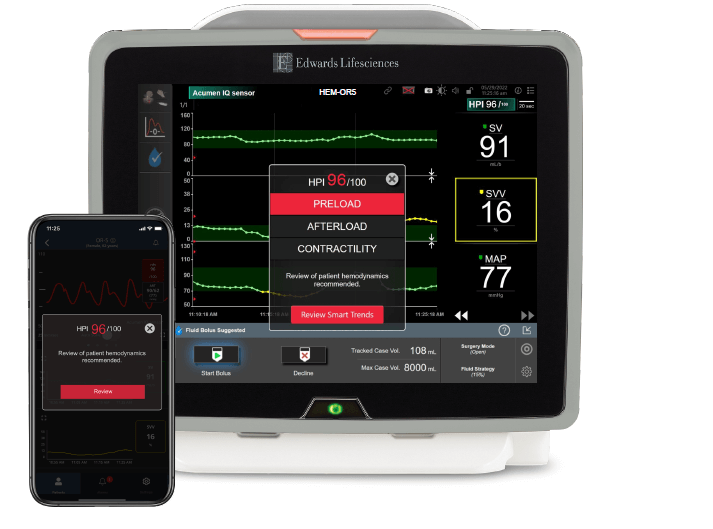 HemoSphere | Edwards Lifesciences