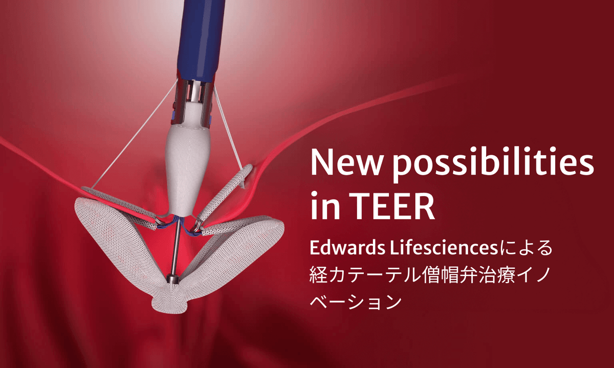 PASCAL Precision システム | Edwards Lifesciences