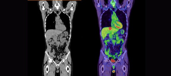 PET-CT | I-MED Radiology Network